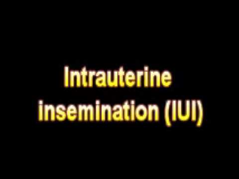 What Is The Definition Of Intrauterine insemination IUI Medical School Terminology Dictionary