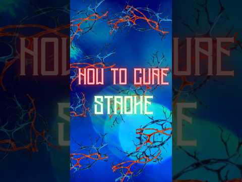 STROKE: Why Every Second Could Save a Brain!