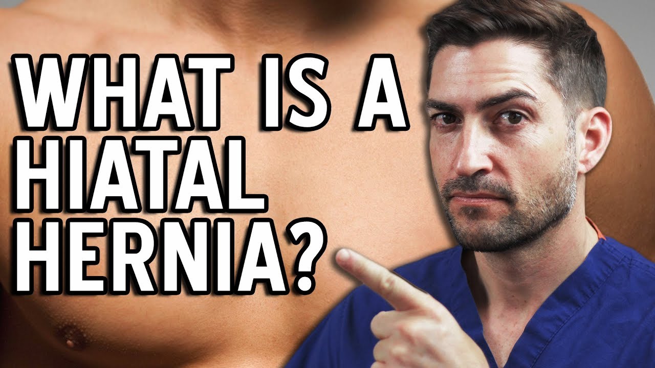 Hiatal Hernia - All 4 Types Explained!