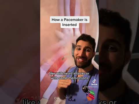 How a Pacemaker is Inserted #heartblock