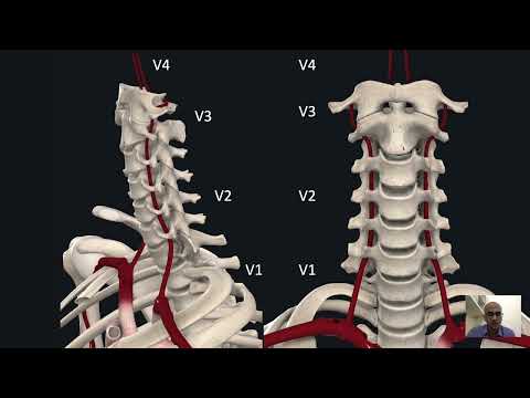 Tracking Vertebral Artery - Safe Anatomical Corridors