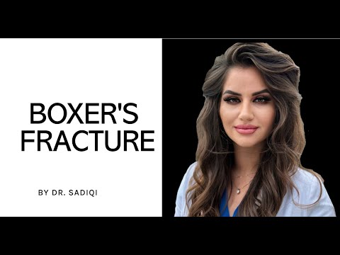 Boxer's Fracture??