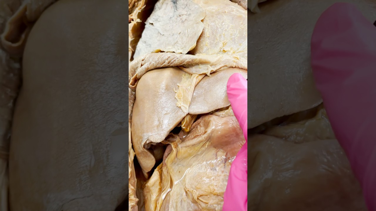 Cancerous Liver vs Healthy Liver