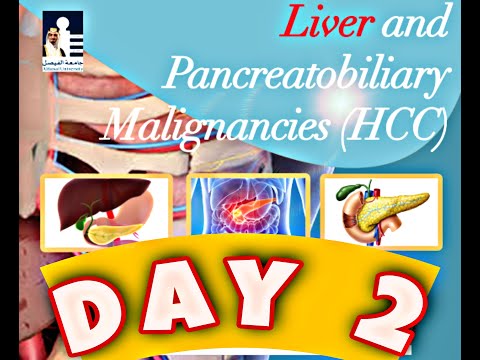 The Challenging Cases - Case presentation of cholangiocarcinoma Speaker: Dr. Ali Al Faqeeh