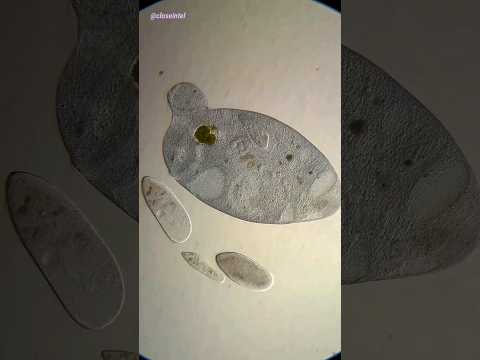Cell Living Inside of Another Cell Under Microscope (Stentor and Paramecium)