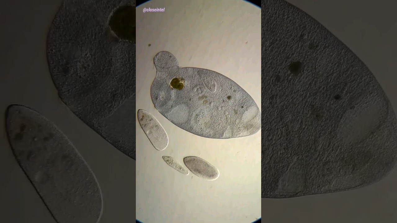 Cell Living Inside of Another Cell Under Microscope (Stentor and Paramecium)