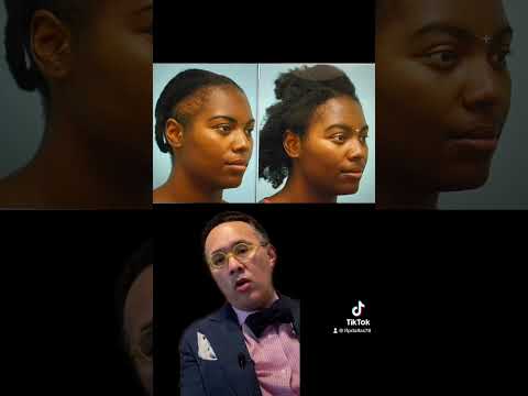 Understanding Traction Alopecia