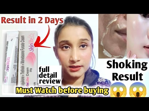 Skinlite Cream - Skinlite Face Cream Latest Price, Dealers & Retailers ...
