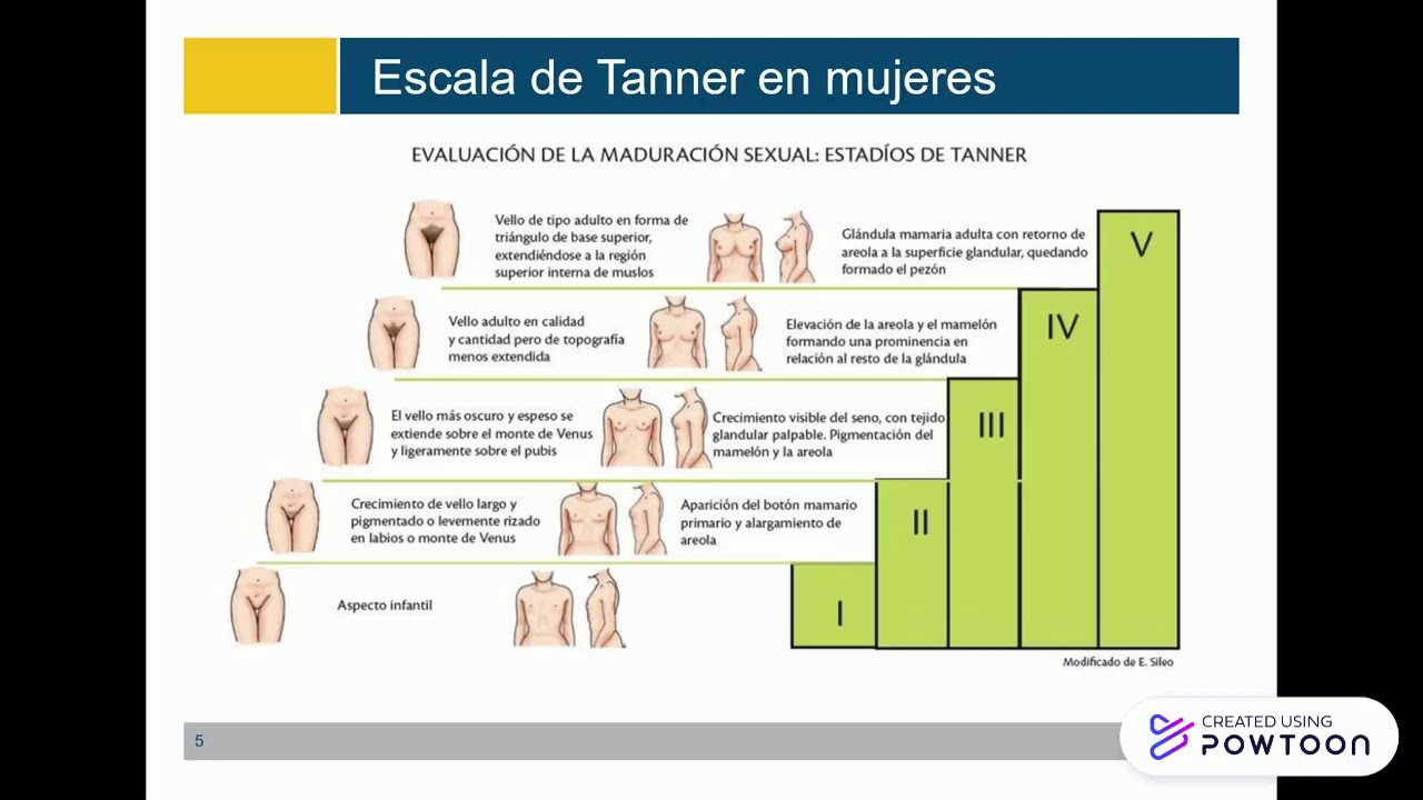Escalas de Tanner