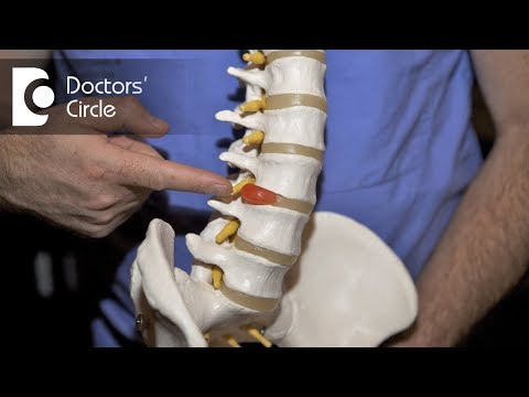 What is Cervical Radiculopathy or pinched nerve & its causes? - Dr. Manjunath A