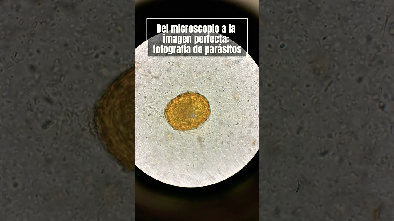 Aprende a tomar las mejores fotos de parásitos #fotos #laboratorio #science
