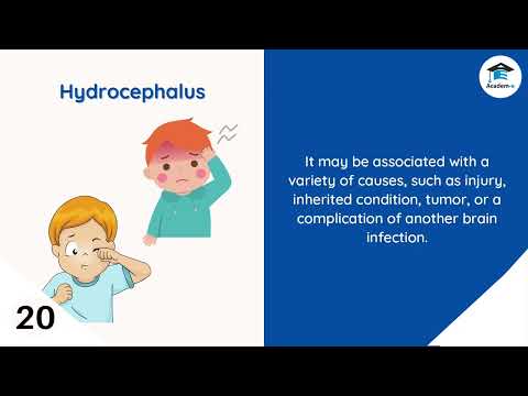 SCIENCE06L01: The Nervous System