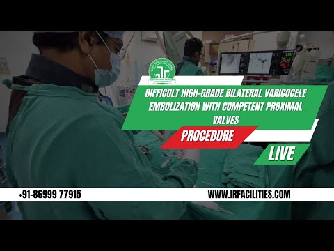 Difficult High-Grade Bilateral Varicocele Embolization with Competent Proximal Valves | IRFACILITIES