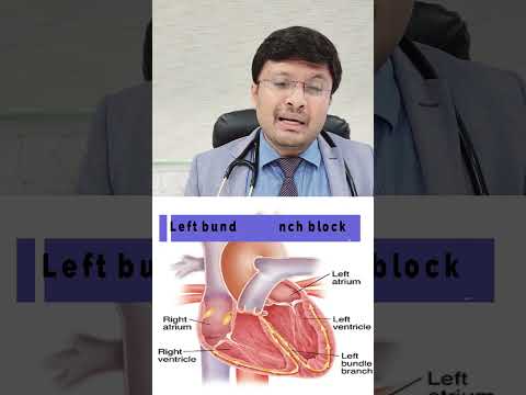 RBBB vs LBBB: Which Heart Issue Wins? (Shocking Facts!)"