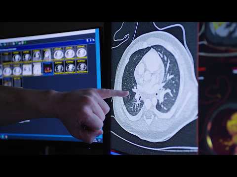 How photon-counting CT is improving access to advanced medical imaging
