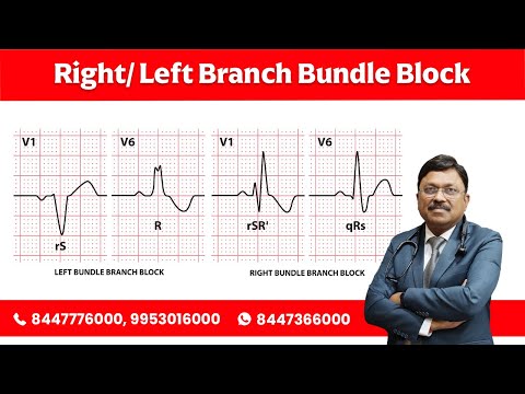 Right/Left Branch Bundle Block by Dr. Bimal Chhajer