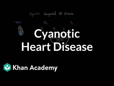 What is cyanotic heart disease | Circulatory System and Disease | NCLEX-RN | Khan Academy