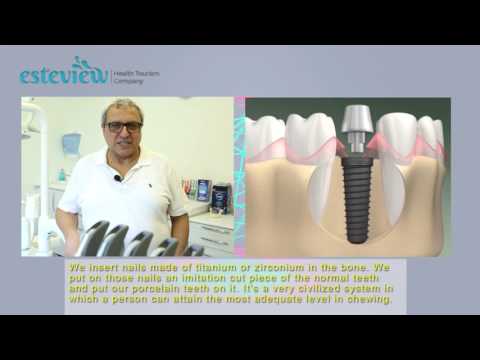 Dr. Dt. Serdar Gözler – Dentist- What is an Implant?