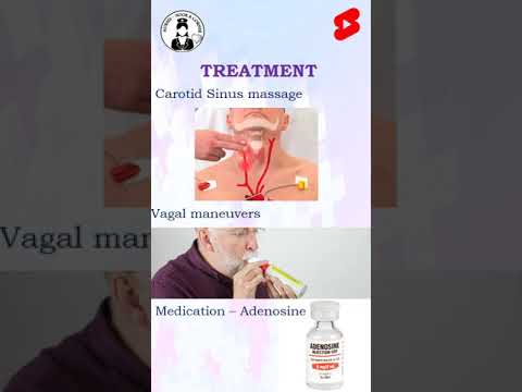 Supraventricular tachycardia (SVT) - An Abnormal rhythm
