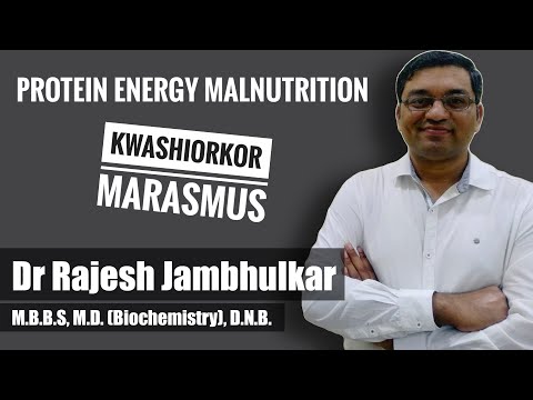 PROTEIN ENERGY MALNUTRITION (PEM)- Kwashiorkor and Marasmus