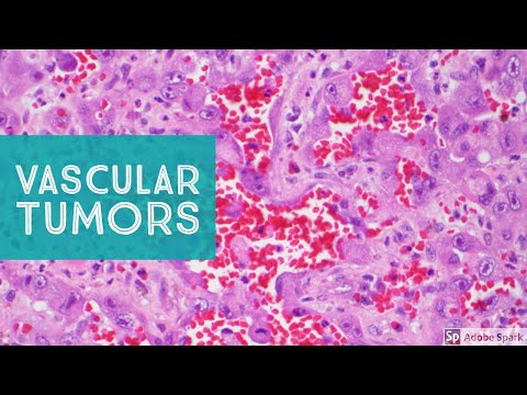 Vascular Tumors of the Skin - Explained by a Soft Tissue Pathologist