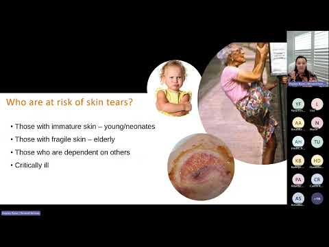 Breaking the Cycle: Preventing and Treating Skin Tears Effectively