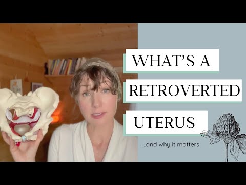 What is a Retroverted Uterus?