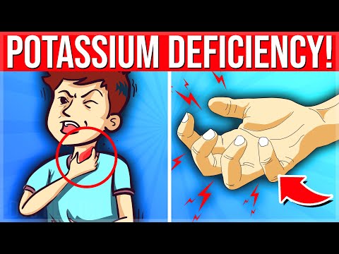 You're Potassium Deficient If You Have THESE 11 Warning Signs - (Hypokalemia)