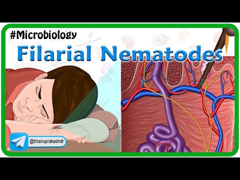 Filarial nematodes Animation🐛: Wuchereria, onchocera volvulus, Loa-Loa, Dracunculus, Trichinella