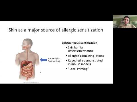 [Daniel  Waizman] Skin damage signals mediate allergic sensitization to spatially unlinked antigen
