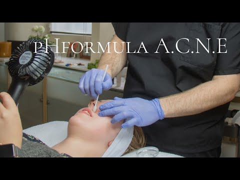 pHformula A.C.N.E Peel | DERMAGURU