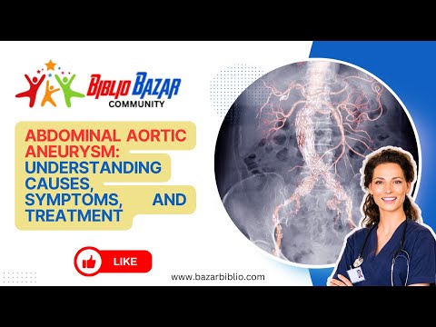 Understanding Abdominal Aortic Aneurysm: Causes, Symptoms, and Treatment 🏥