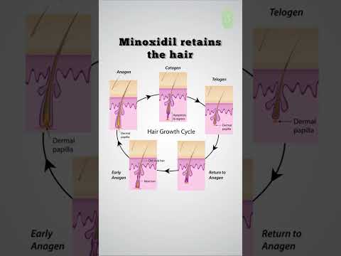 Does hair fall increases if you stop using Minoxidil?
