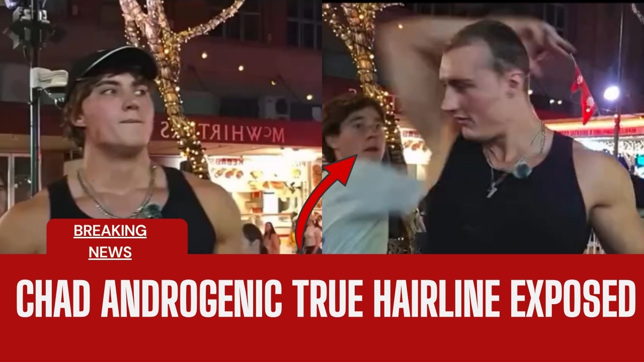 CHAD Androgenic Wig Snatched Exposing His True Hairline