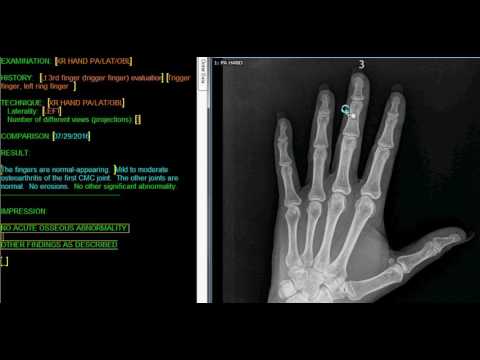 Fingers/DIgits Naming and Numbering