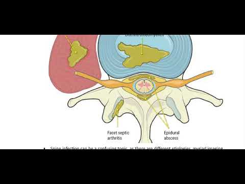 Spine imaging core radiology visualsㅣradiopaedia@ctisus @navigatingradiology