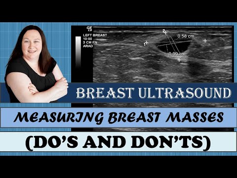 Breast Ultrasound - Measuring Breast Masses (Do's & Don'ts) | Registry Review Series