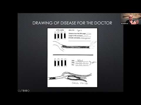 Understanding Your ABI and Ultrasound | Peripheral Artery Disease