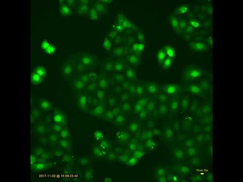 UC Berkeley Calcium Lab Time-Lapse Microscopy