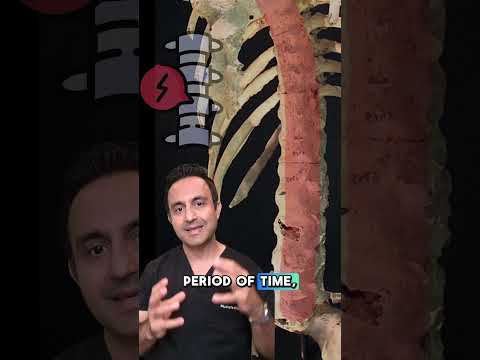 bamboo-spine disease #ankylosingspondylitis
