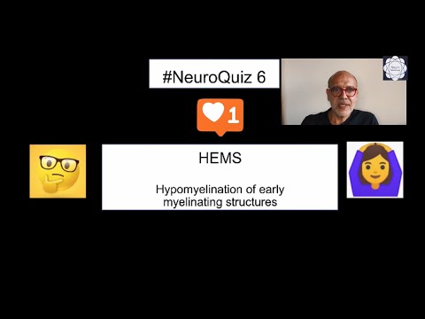 NeuroQuiz 6 - Solution.
