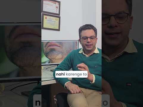 What is Alopecia Areata? How to treat it effectively?