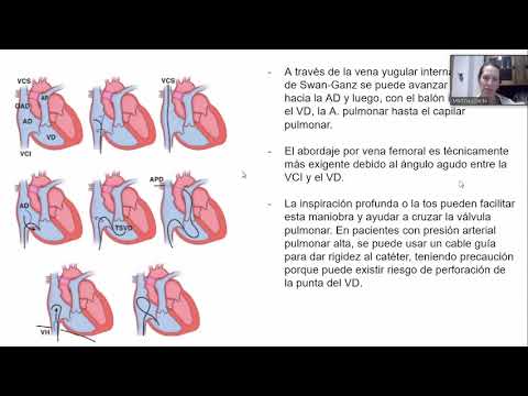 Monitoreo hemidinamico