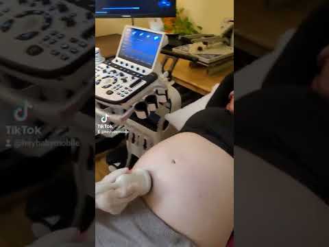 Clowns and Monsters doing ultrasounds for Halloween