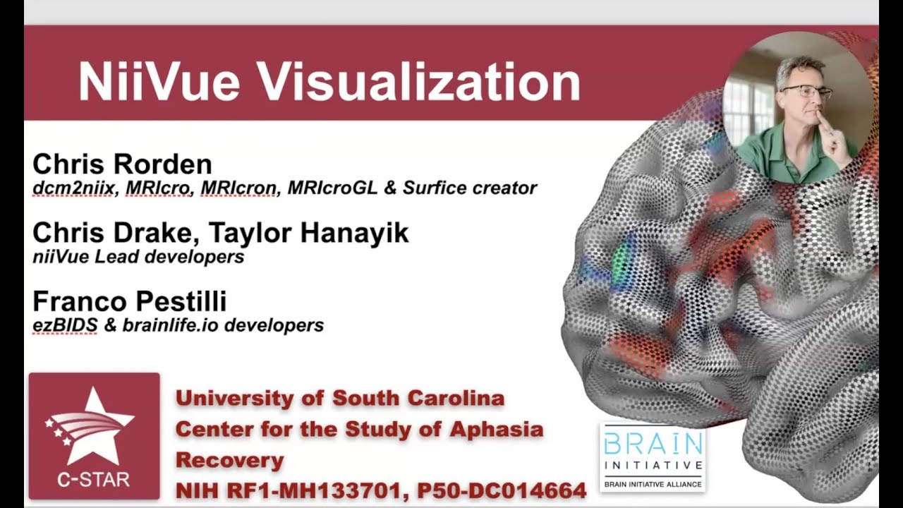 NiiVue Visualization