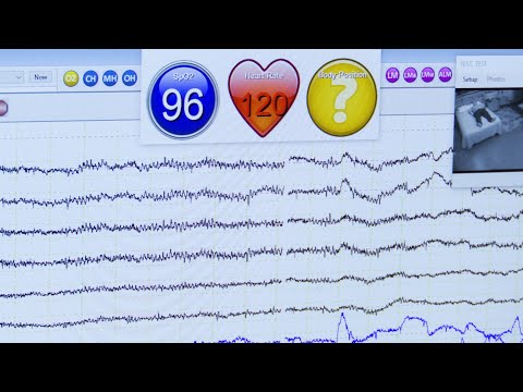 Sleep Study