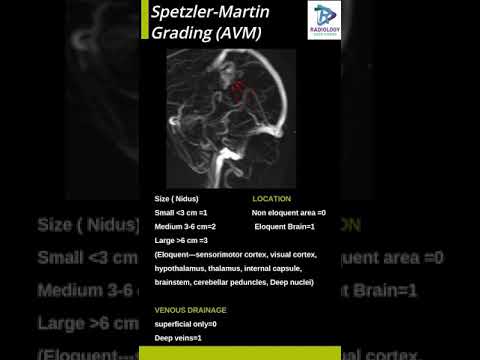 Spetzler-Martin Grading (AVM)