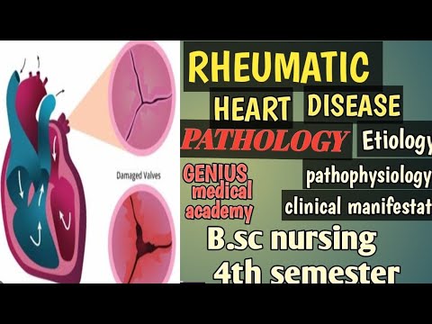 RHEUMATIC HEART DISEASE PATHOLOGY B.SC NURSING 4TH SEMESTER