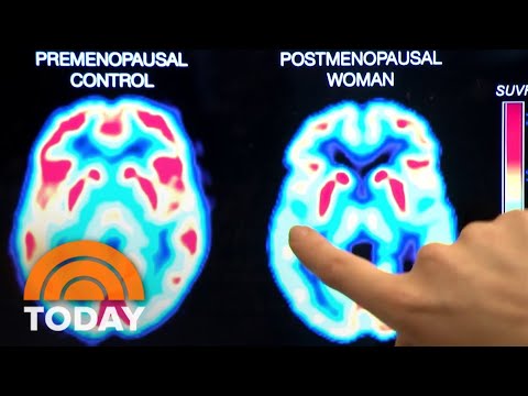 What is ‘menopause brain’ and how can people navigate it?