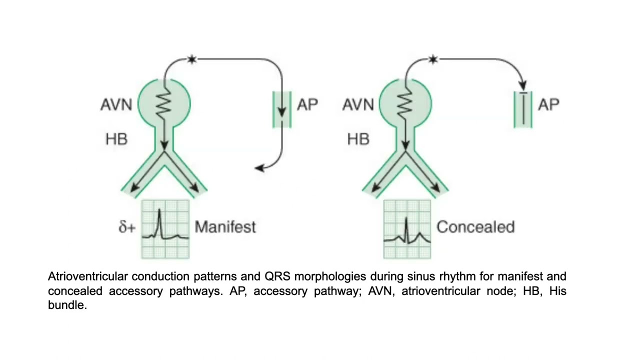 Is the PR interval normal? | Dr RR Baliga's 